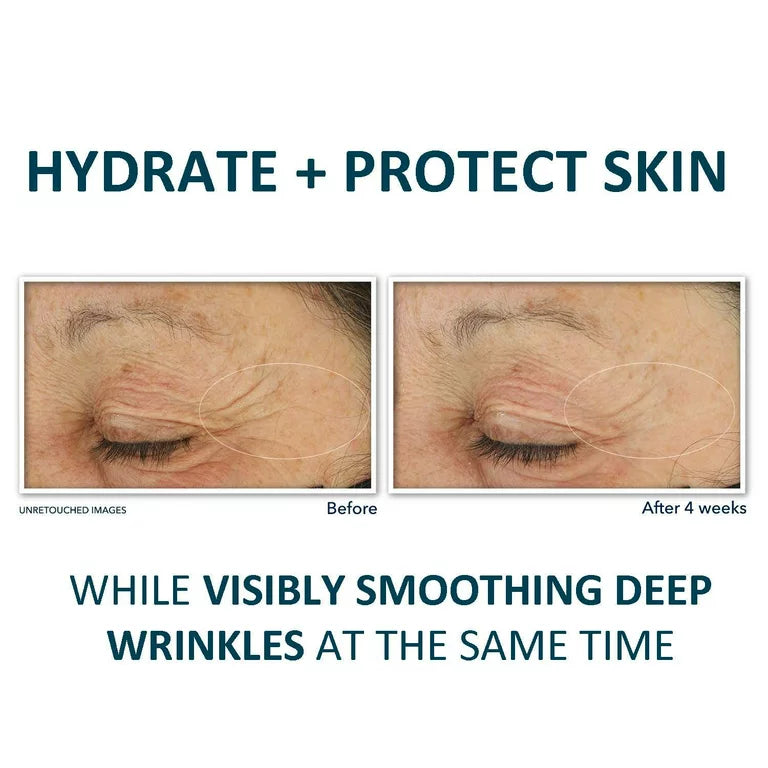 RoC Retinol Correxion® Deep Wrinkle Daily Moisturizer With SPF 30 RoC Retinol Correxion® Deep Wrinkle Daily Moisturizer With SPF 30