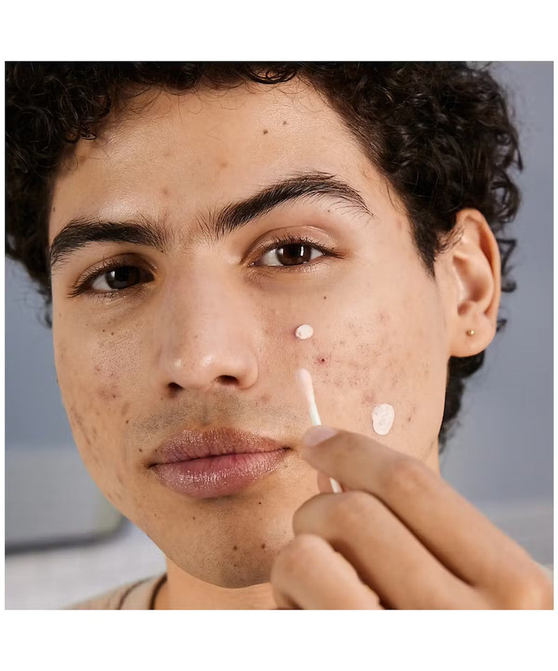 Neutrogena Stubborn Acne™ Spot Drying Lotion – Medoget